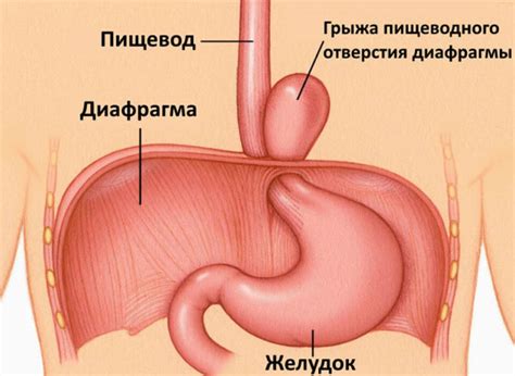 Кислый привкус во рту причины, лечение, как от него избавиться