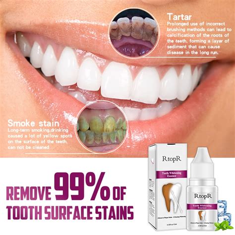 Teeth Oral Hygiene Essence Whitening Essence - GearBeauty