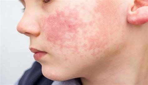 Dermatology-skin | Om Multispeciality Hospital | Multi Specialty ...