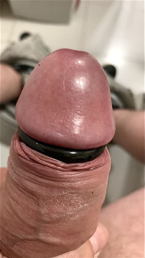 New Glans Rings - 29 Pics | xHamster