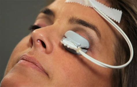 LipiFlow: Dry Eye Treatment | Abbey Eye Care