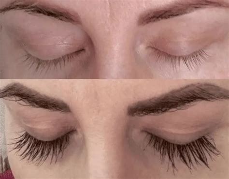 Want an Eyelash Growth Serum That Works? 7 Key Things to Look For