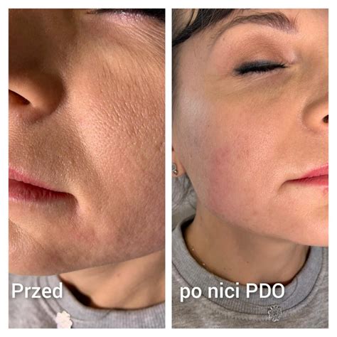 Nici PDO - Atelier BlueBetty