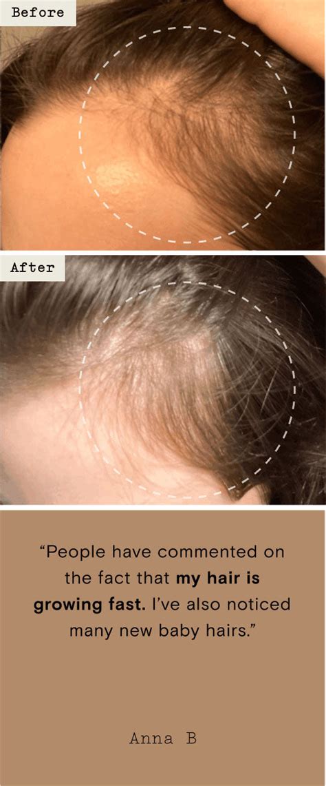 SuperHair: Vegan Hair Supplement & Multivitamin | Moon Juice