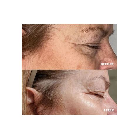 HydroPeptide Vital Eyes Instant Awakening Serum - EDCskincare