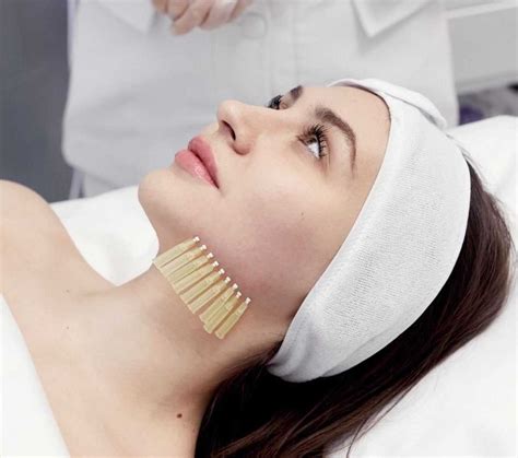 Итальянские нити Dermafil® Happy Lift – революция в лифтинге | Клиника ...