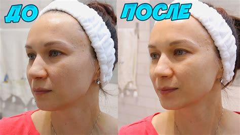 Гидрогелевые маски #атоми - YouTube