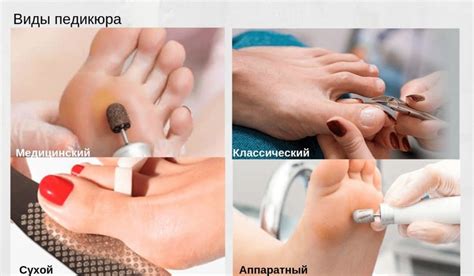 Педикюр: подготовка, советы (фото, видео)
