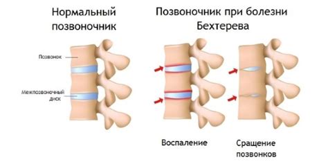 Костарокс. Инструкция и показания по применению. Цена. Аналоги. Отзывы