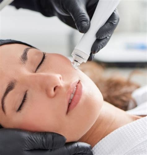 Aquapeel - Beauty & Skincare Schiedam