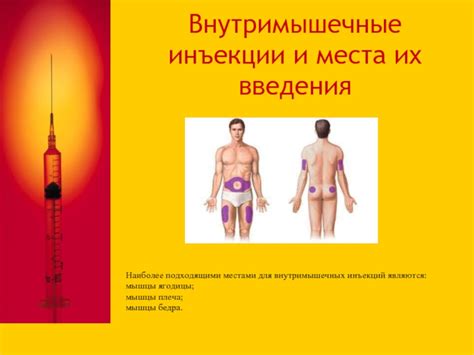 Виды инъекций презентация, доклад