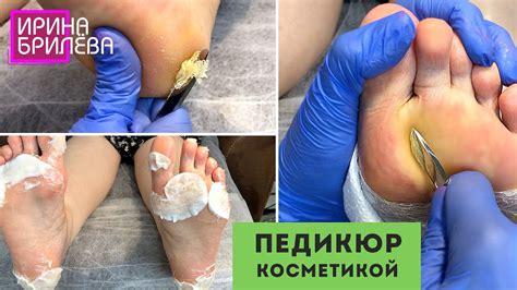 ХОРОШИЙ РЕЗУЛЬТАТ с косметикой в педикюре 🌸 ПРЕПАРАТНЫЙ ПЕДИКЮР 🌸 Ирина ...