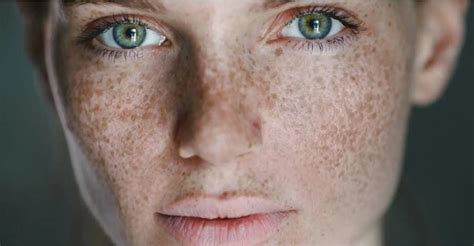 Пигментация кожи: как избежать и как бороться. Beauty Блог салонов ...