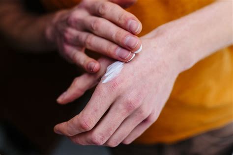 Лекарственные средства от экземы на руках | MedAboutMe