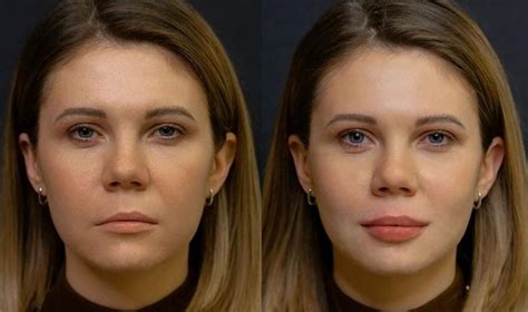 Stylage M (Стилейдж М) для губ. Цена, отзывы — Женские Секреты: красота ...