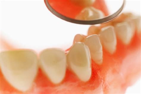 🦷 Лечение десен под протезами. Или как его избежать?