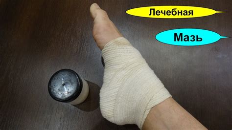 Боль в пятке или пяточная шпора лечение. Сильнейшее народное дешевое ...