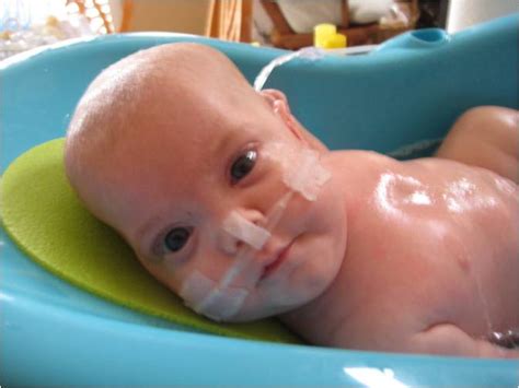 Tips for babies going home on oxygen