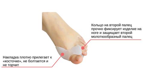 Фиксатор силиконовый для большого пальца ноги – Фиксаторы косточки для ...