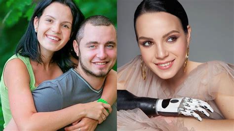 Маргарита Грачева, лишившаяся рук из за мужа тирана: «Наступила стадия ...