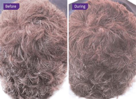 Anti Grey Hair Serum | Greyverse™ & Darkenyl™ | Reverse grey hair ...