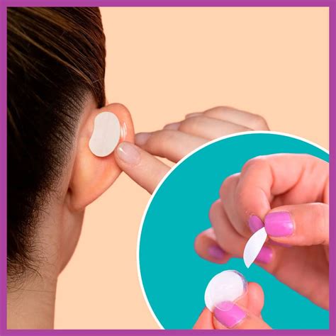 Otostick - Otostick USA | Aesthetic Ear Corrector