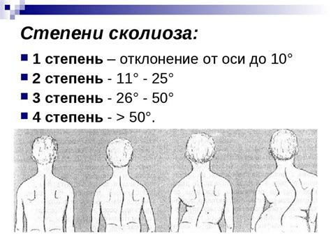 Как избежать сколиоза | ЧОЦМП