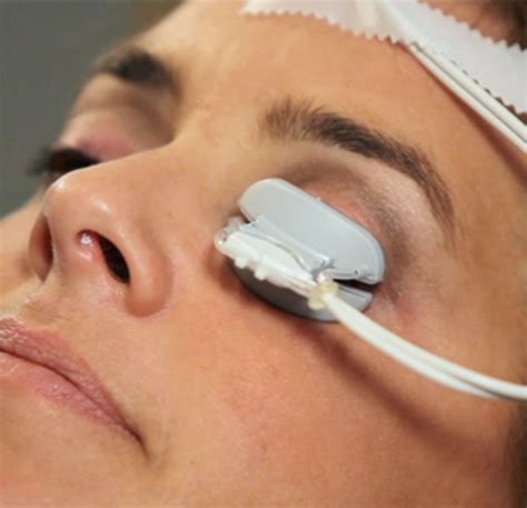 LipiFlow - Oftalmologia