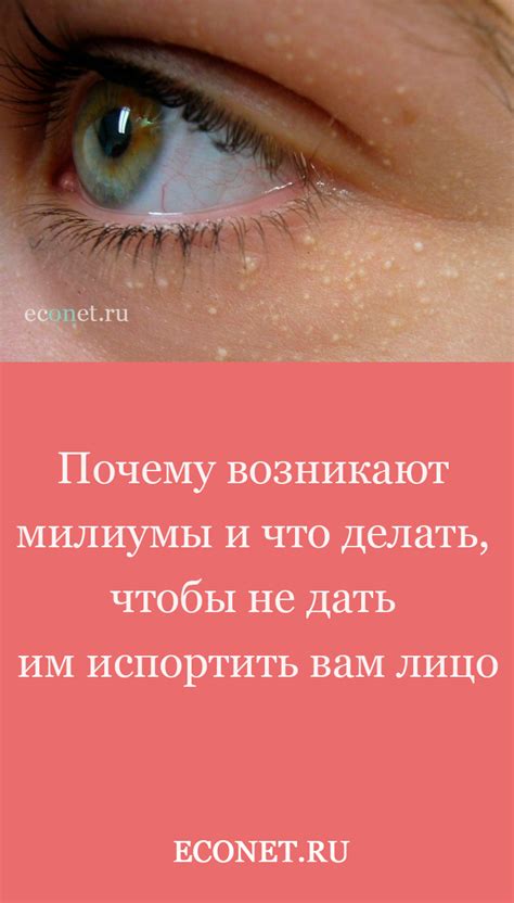 Что такое милиумы на лице фото