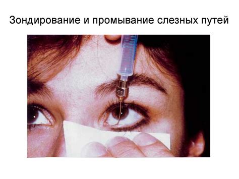 Воспалительные заболевания глаз и вспомогательного аппарата ...