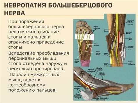 Болят икры ног: у женщин, у мужчин, зуд, жжение, причины, чем лечить