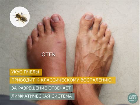 Отеки Ног Фото — Bluemorphotours.ru