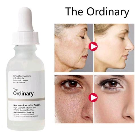 Ordinary Serum