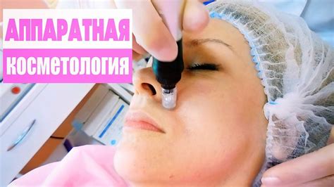 Аппаратная фракционная мезотерапия