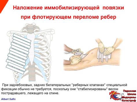 Травма груди - презентация онлайн