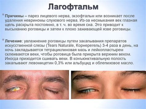 Особенности блефарита. общие принципы лечения блефарита. лечение