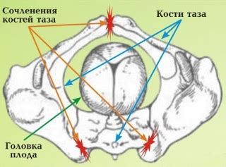 Симфизит при беременности: причины, симптомы и лечение
