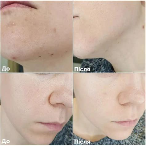 ᐉ Пилинг-диски с BHA и PHA кислотами Needly Daily Toner Pad 60 шт ...