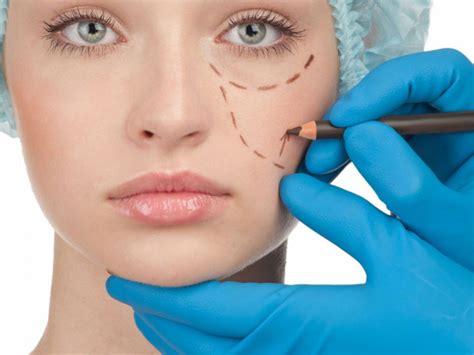 Фоторезультаты эндоскопической подтяжки лица до и после - Med-Est | Мед-Эст