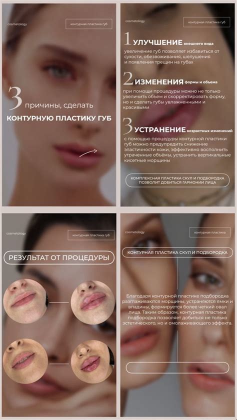 Оформление сторис | Косметолог, Косметология, Губы