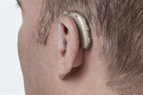 Spotlight: Oticon Xceed