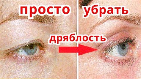 Нависшее Веко,Кожа Вокруг Глаз разгладится СРАЗУ! Маска от Дряблого ...
