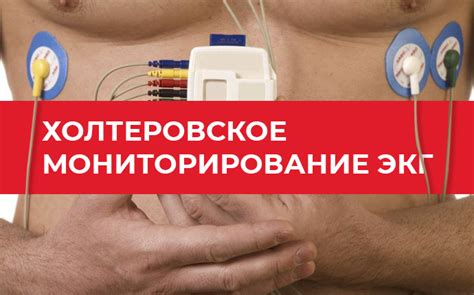 Холтеровское мониторирование ЭКГ - Tkachenko Cardiology