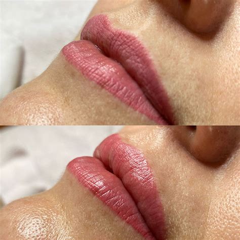 CooLifting Beauty Gun I Bar à Beauté Beauty Clinic