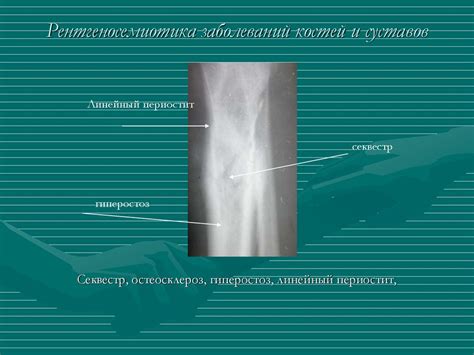 Лучевое исследование костей и суставов - презентация онлайн