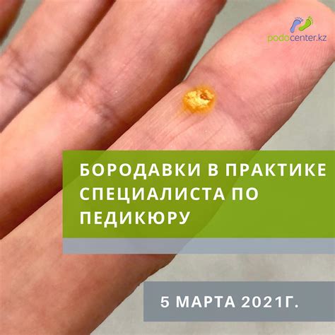 Podocenter.kz - 5 марта 2021 г. состоится семинар: “БОРОДАВКИ В ...