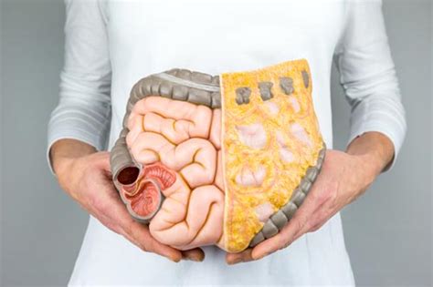 What is a Stoma – The Australian Council of Stoma Associations Inc