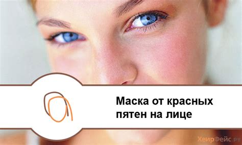 Как избавиться от красных пятен на лице – причины возникновения ...