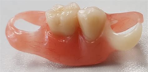 qdent semiflex acrylic