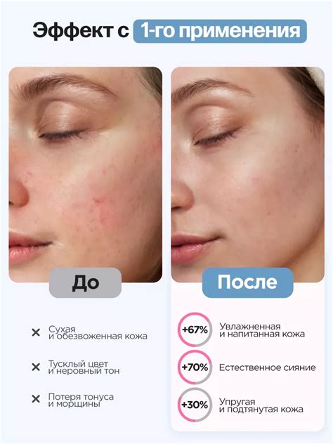 Маска для лица тканевая набор 30шт VOIS купить по цене 630 ₽ в интернет ...